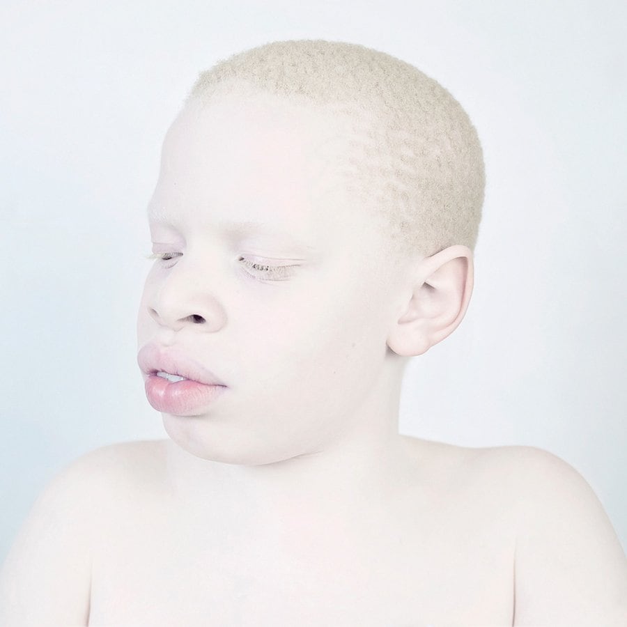 Fragile Snow White Portraits of Albinos by Sanne De Wilde | FREEYORK